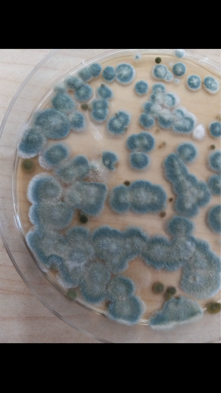 Mold Testing with Petri Dishes- Collection Process Explained