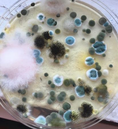 mold-testing-petri-dish | EndSickness.org
